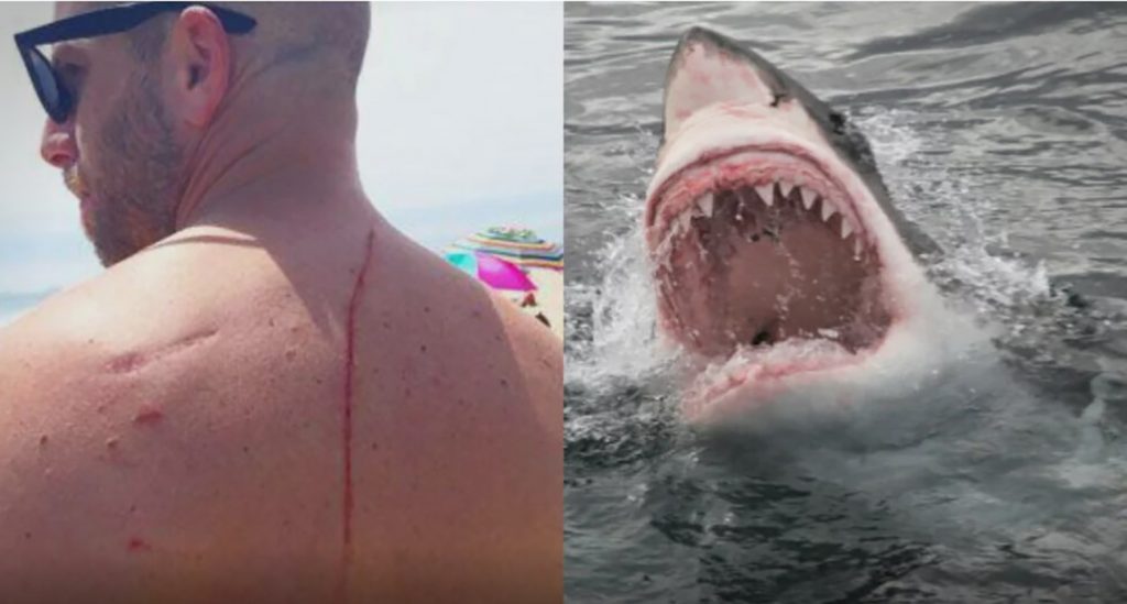 Ajkula napala muškarca i spasila mu život?! | BN