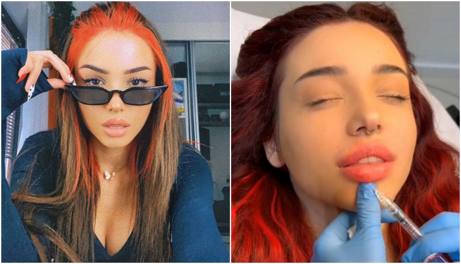 Breskvica - "Prirodna, a sve na licu uradila?" | BN