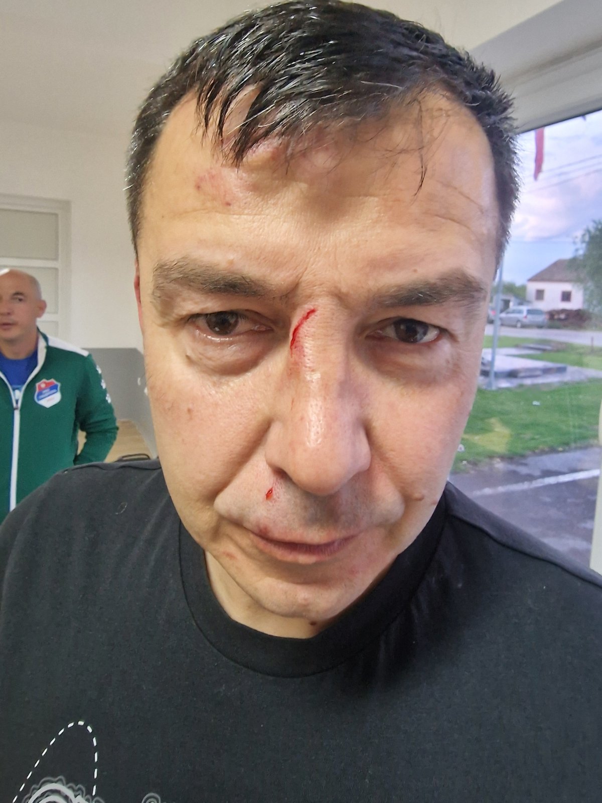 Trojica uhapšena zbog napada na glavnog sudiju | BN