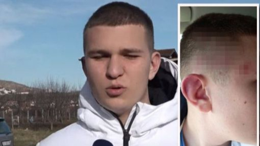 Uhapšen Albanac koji je pretukao dječaka (15) | BN